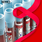 Factors associated with opportunistic infections (OIs) among HIV/AIDS ...