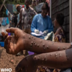 Monkeypox resurgence in Africa: the importance of a coordinated ...